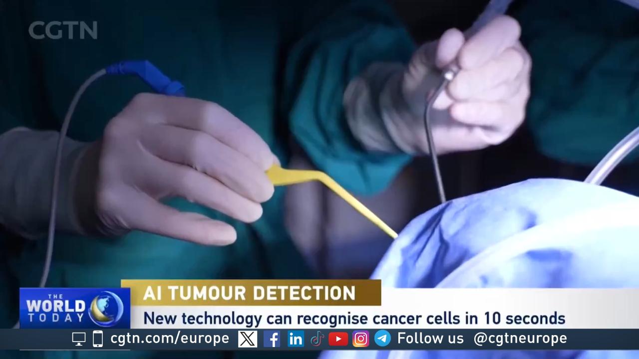 New AI detects tumor cells within seconds, cutting surgery times - CGTN